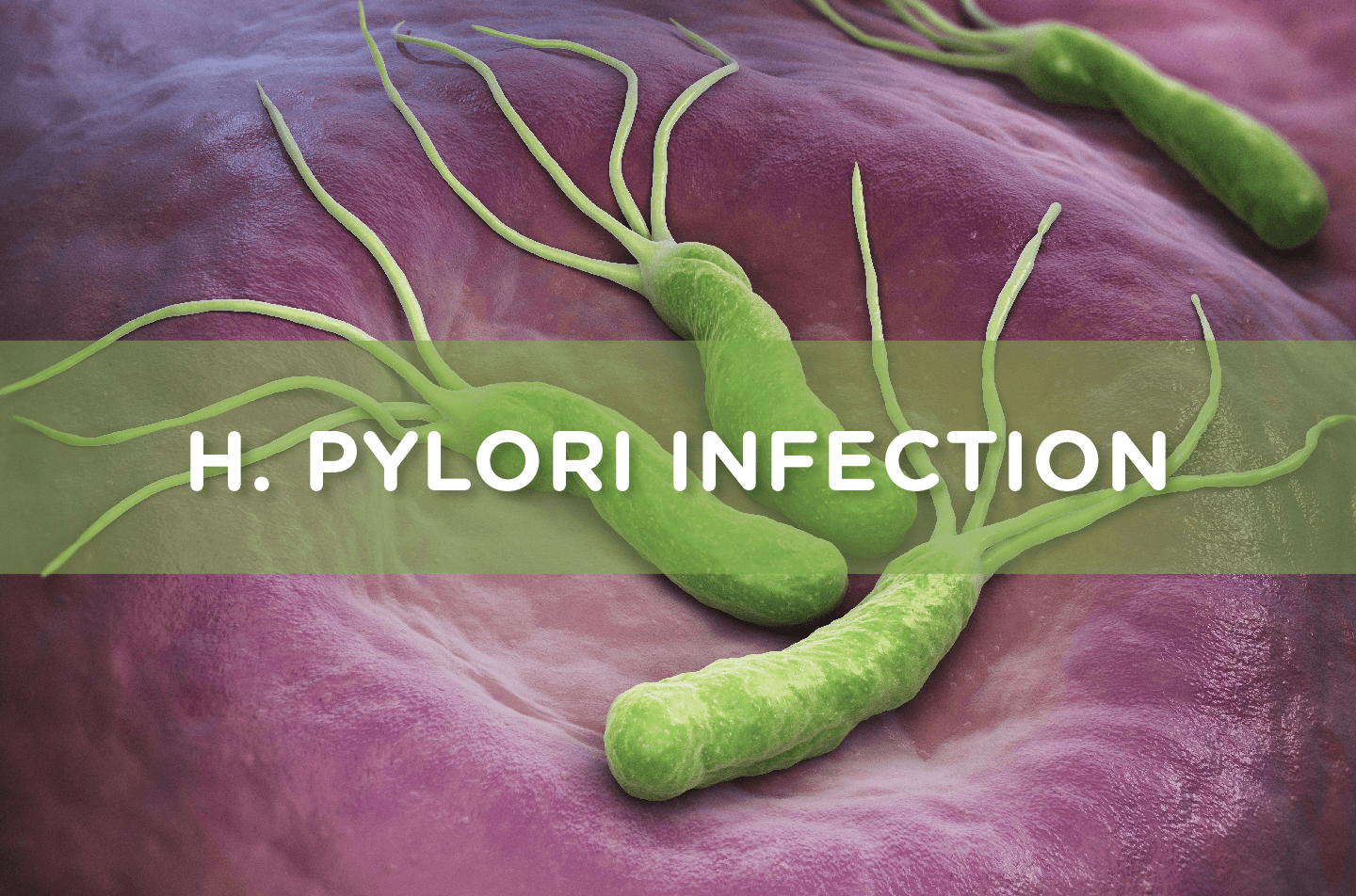 Peptic Ulcers, H.Pylori and the Link to Gut Dysbiosis – Bio-K+